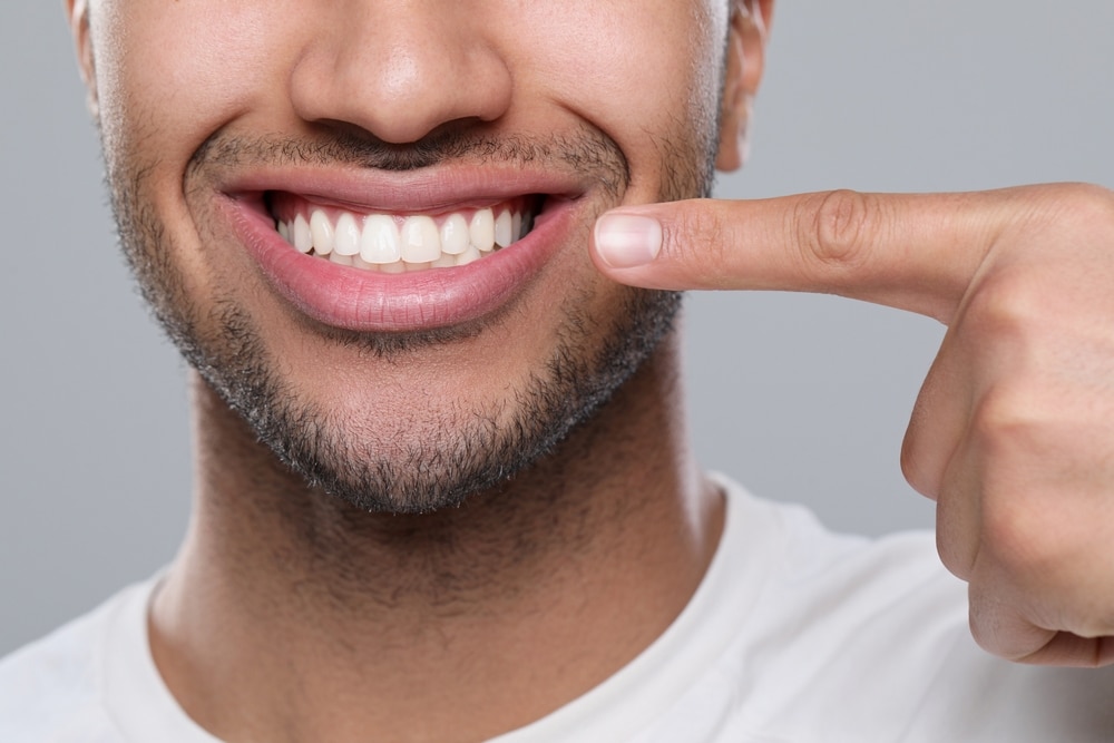 Is Teeth Whitening Safe? Know Before You Brighten Your Smile